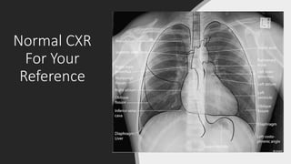 CMC Pediatric X-Ray Mastery: 27th Case Series | PPTX | Pregnancy ...