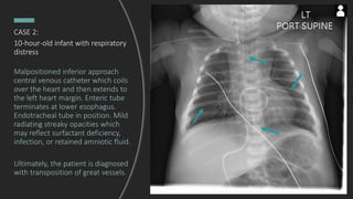 CMC Pediatric X-Ray Mastery: 27th Case Series | PPTX | Pregnancy ...