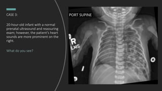 CMC Pediatric X-Ray Mastery: 27th Case Series