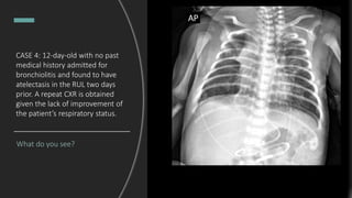 CMC Pediatric X-Ray Mastery: 27th Case Series