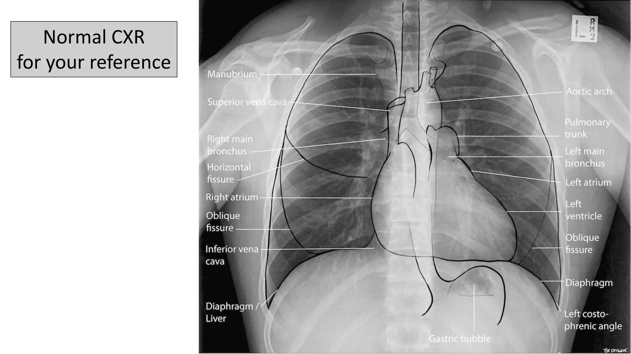 Drs. Potter and Richardson's CMC Pediatric X-Ray Mastery September ...