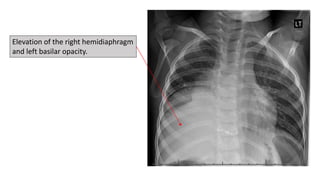 Drs. Potter and Richardson's CMC Pediatric X-Ray Mastery September ...