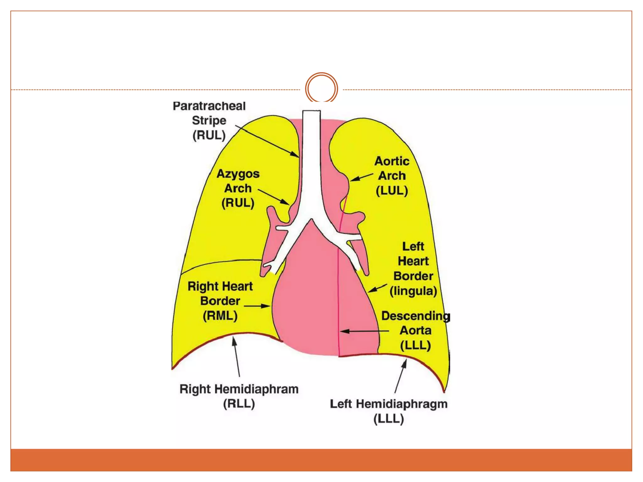 Pediatric chest xray | PPT