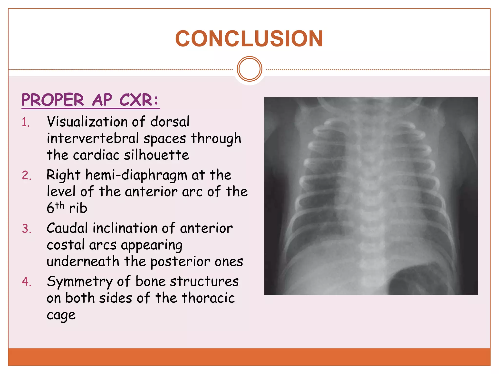 Pediatric chest xray | PPT