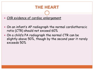 Pediatric chest xray | PPT