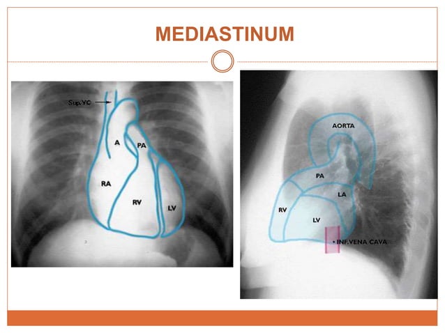 Pediatric chest xray | PPT | Lung and Respiratory Health | Diseases and ...