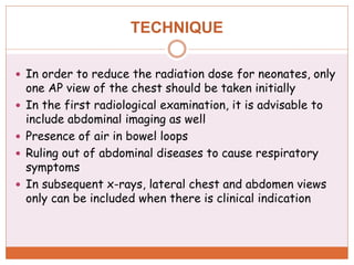 Pediatric chest xray | PPT