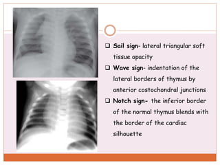 Pediatric chest xray | PPT