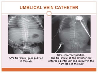 Pediatric chest xray | PPT