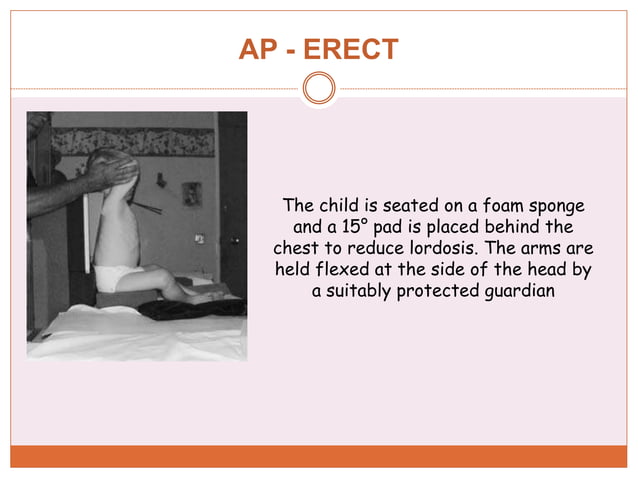 Pediatric Chest Xray Ppt