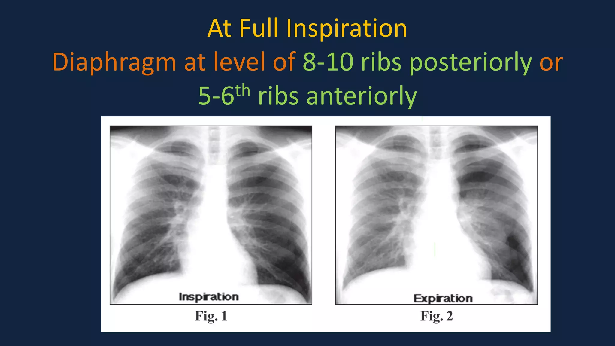 Pediatric Chest x ray Interpretation.pdf