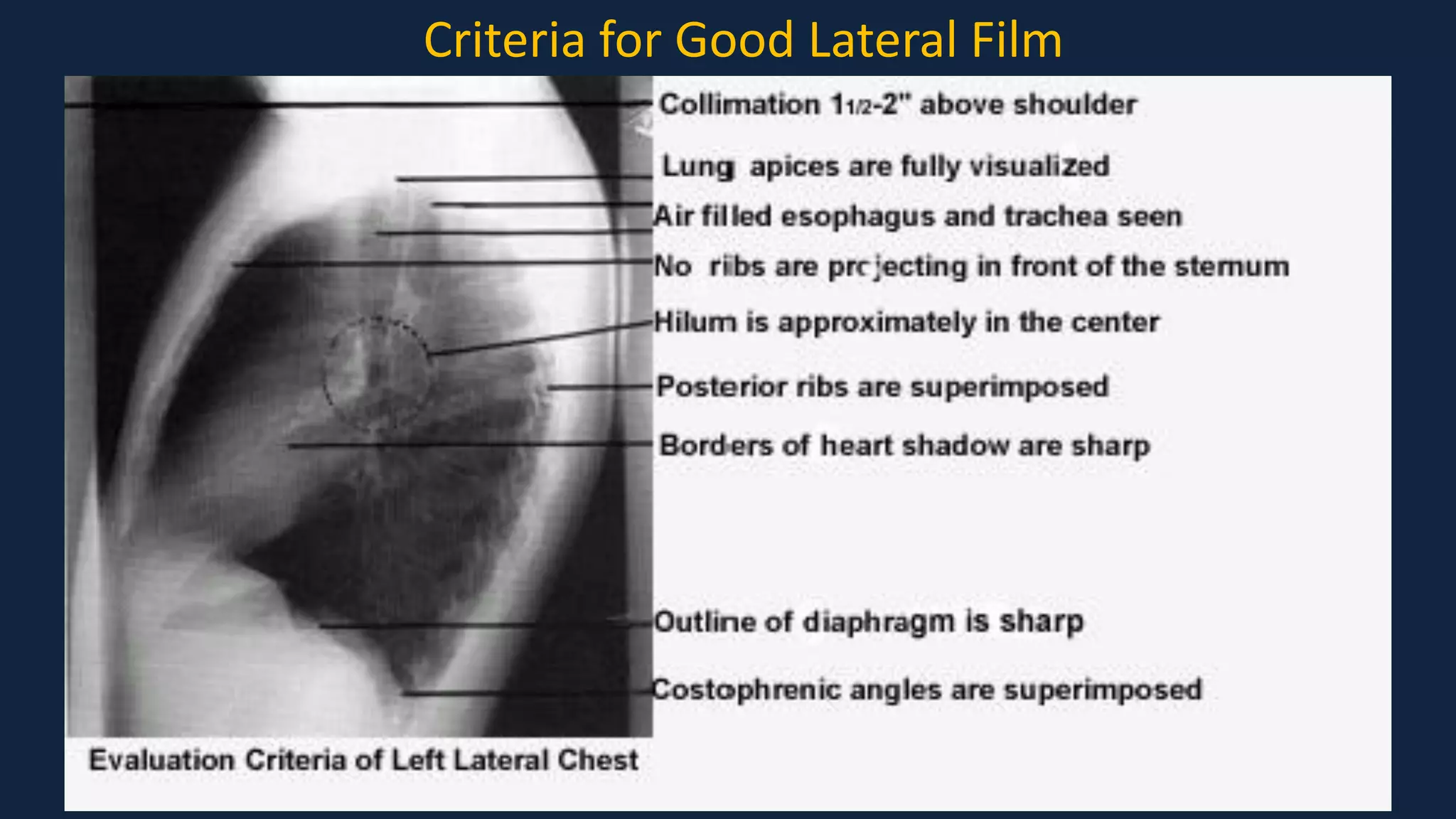 Pediatric Chest x ray Interpretation.pdf