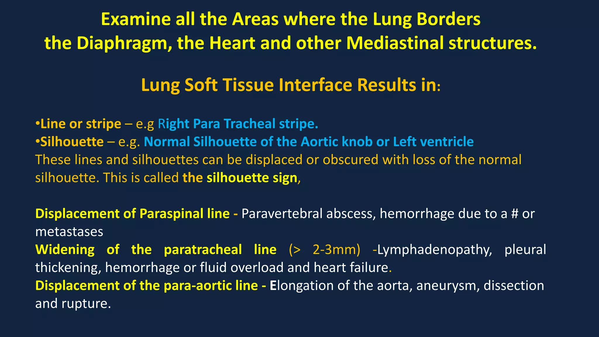 Pediatric Chest x ray Interpretation.pdf