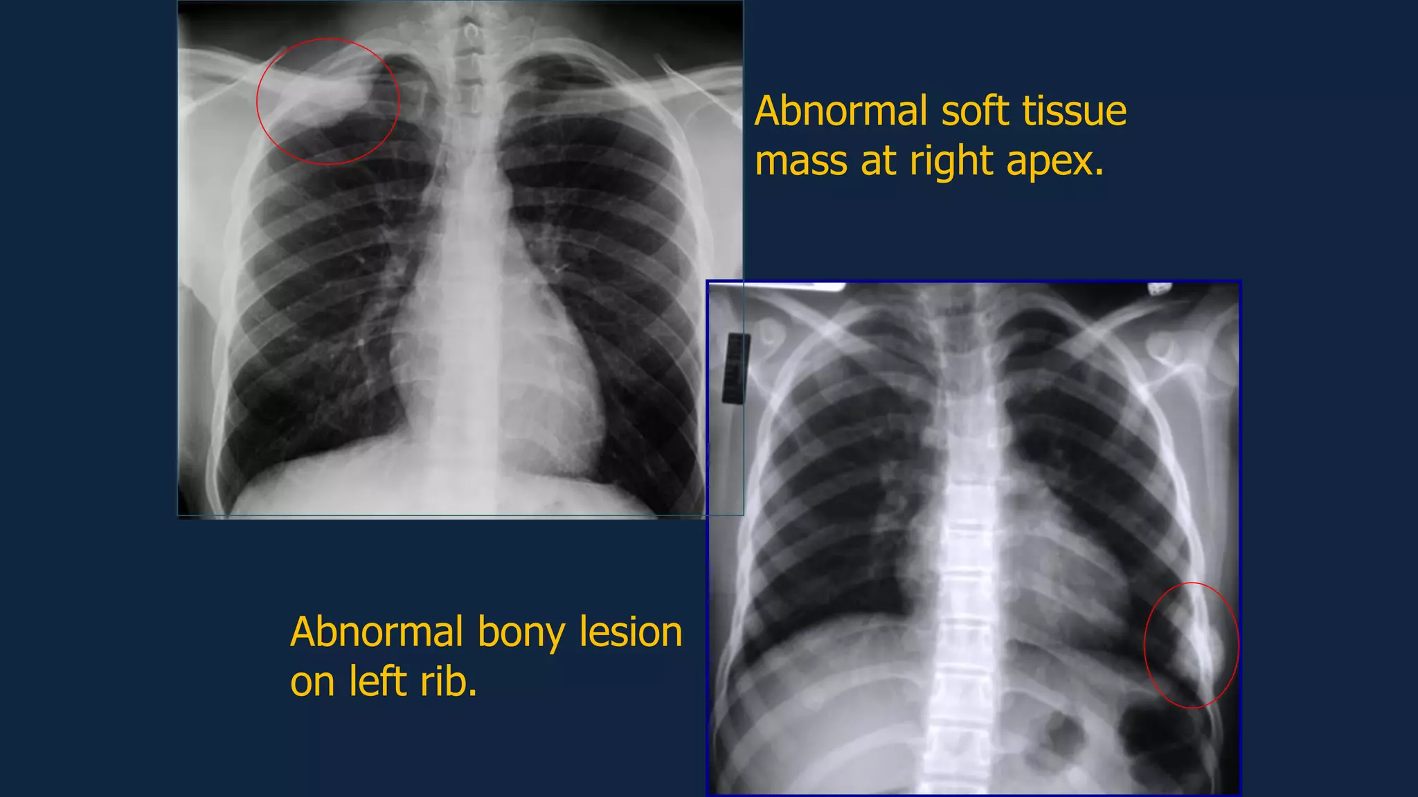 Pediatric Chest x ray Interpretation.pdf