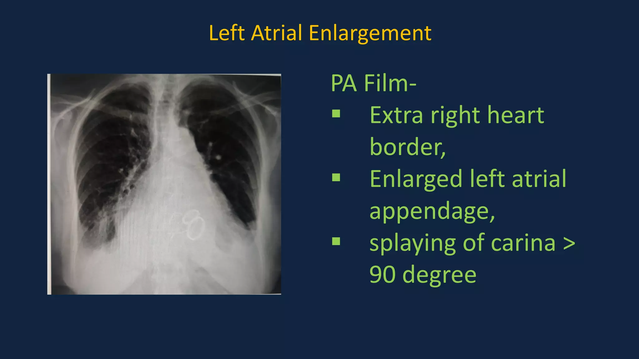 Pediatric Chest x ray Interpretation.pdf