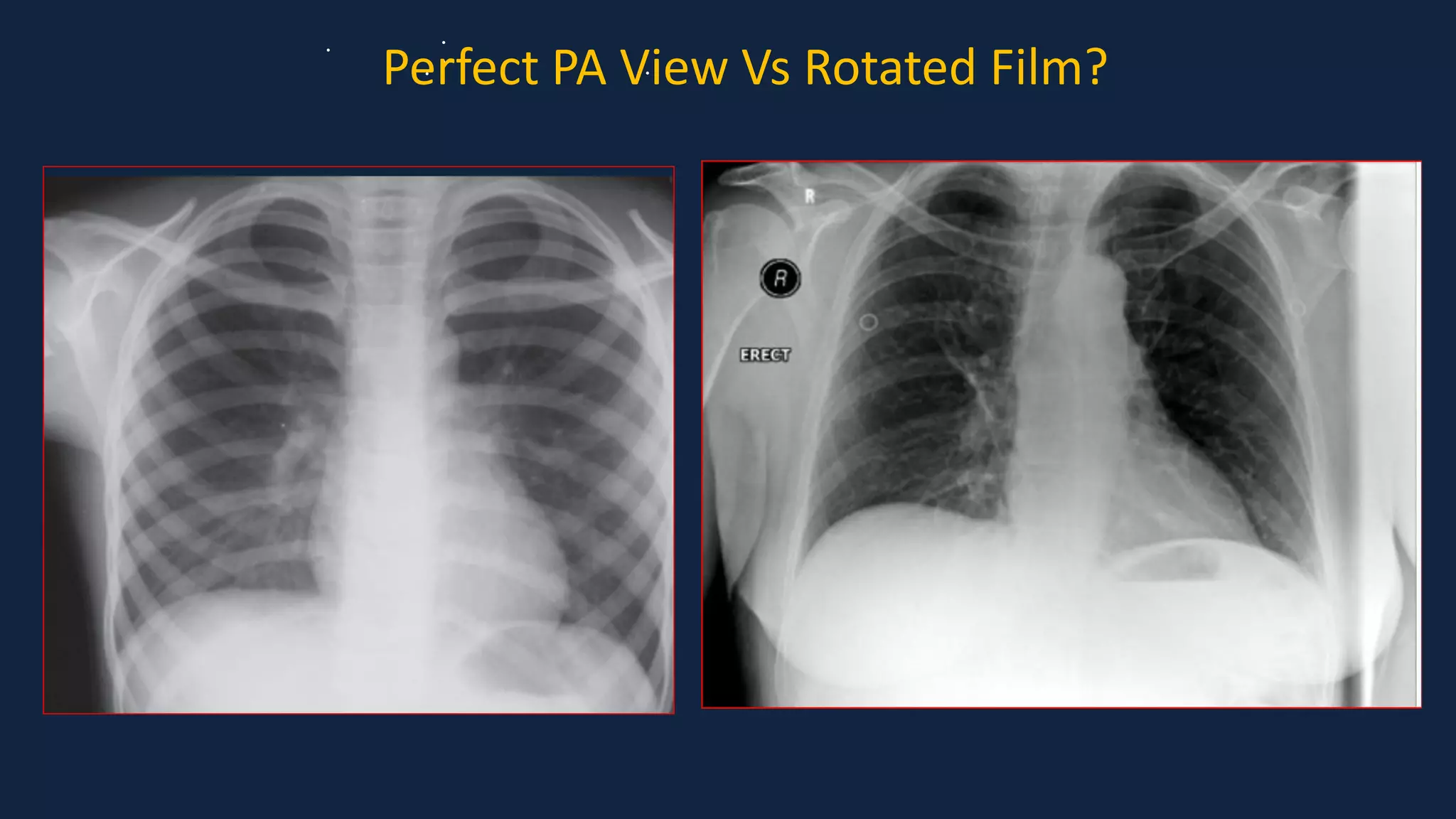 Pediatric Chest x ray Interpretation.pdf