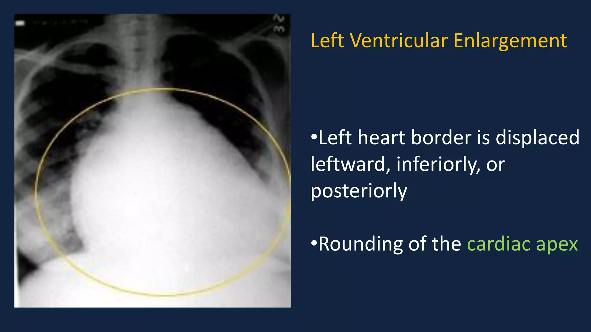Pediatric Chest x ray Interpretation.pdf