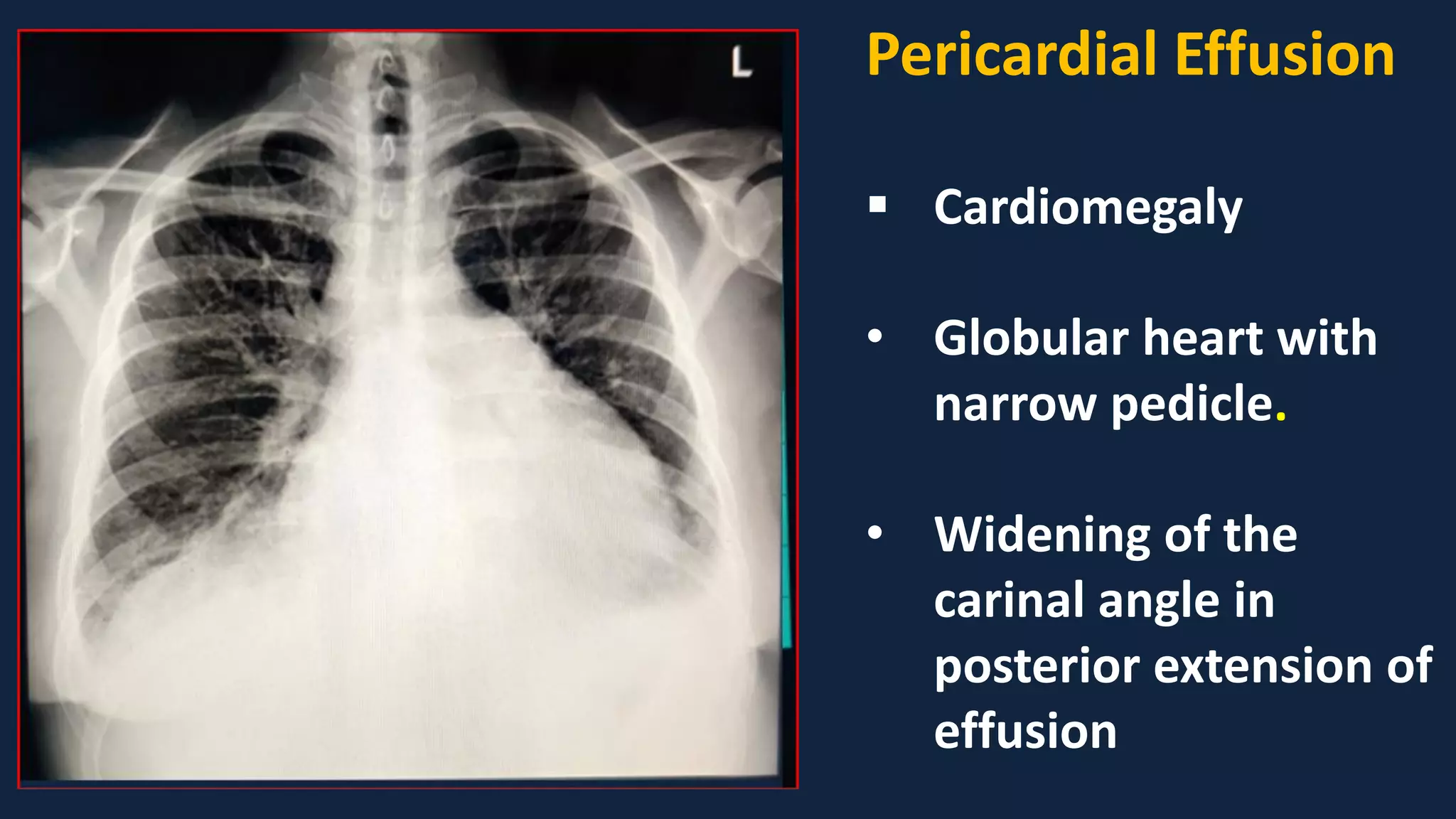 Pediatric Chest x ray Interpretation.pdf