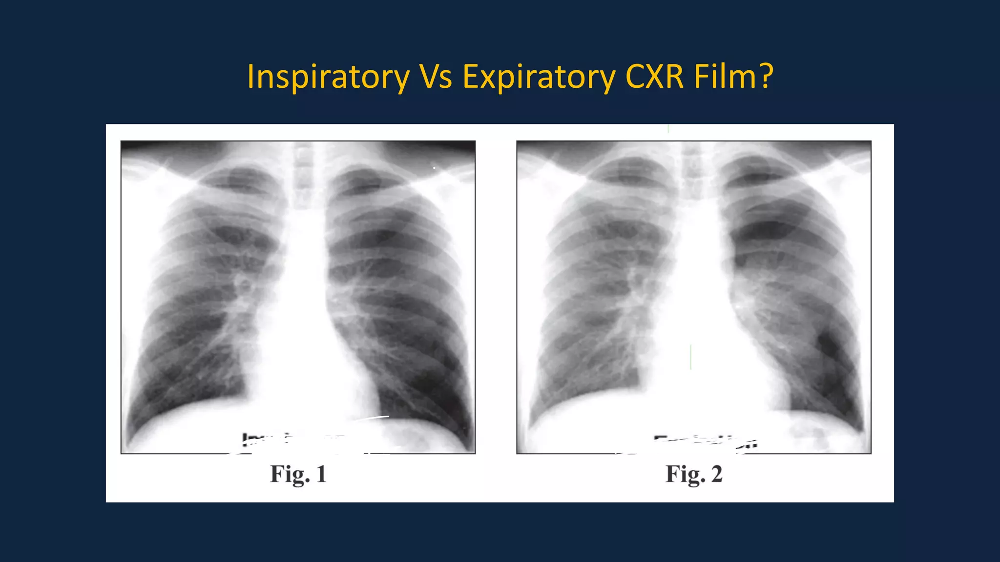 Pediatric Chest x ray Interpretation.pdf