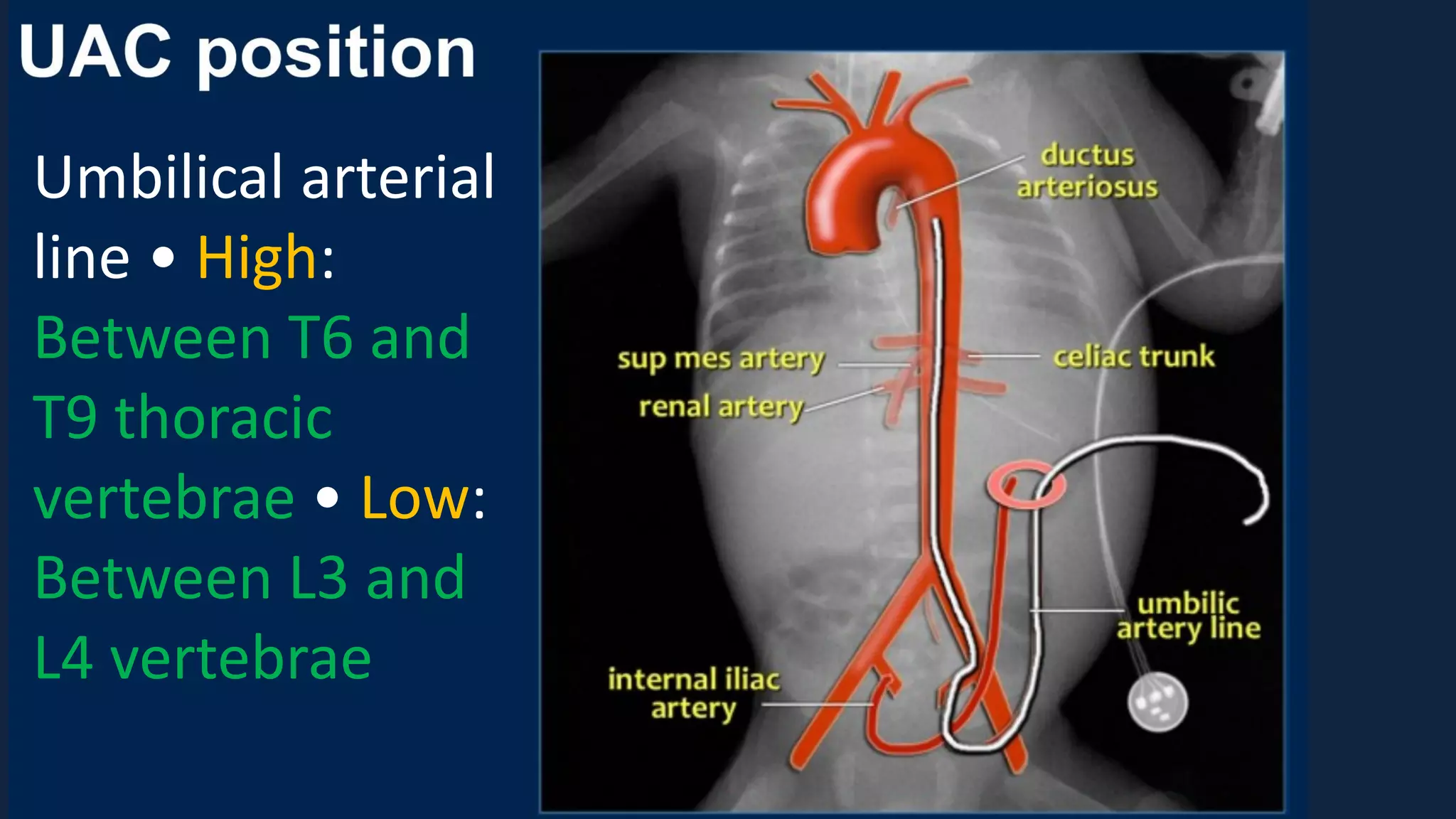 Pediatric Chest x ray Interpretation.pdf