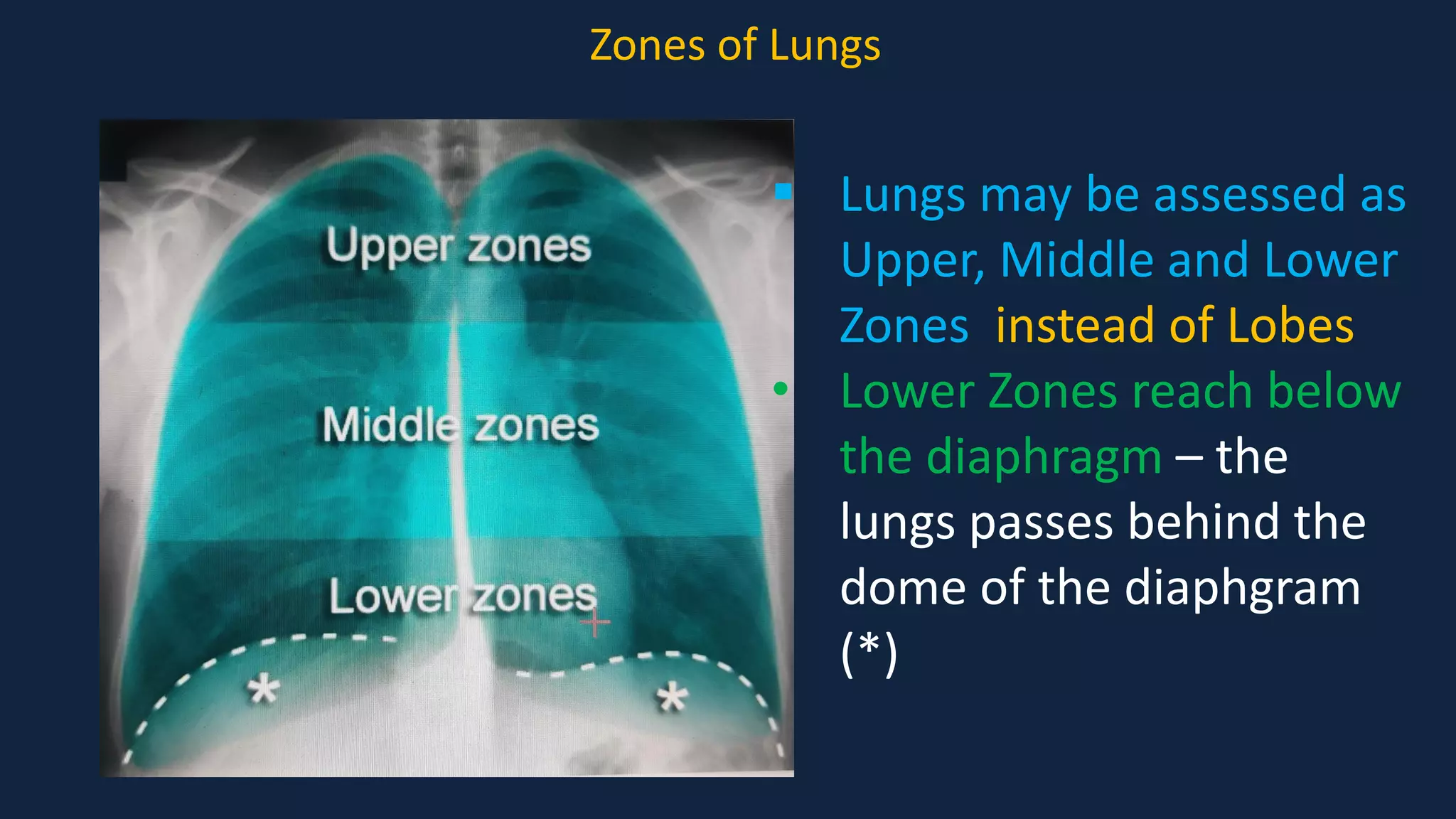 Pediatric Chest x ray Interpretation.pdf