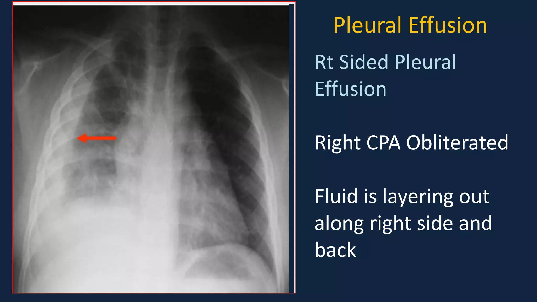 Pediatric Chest x ray Interpretation.pdf