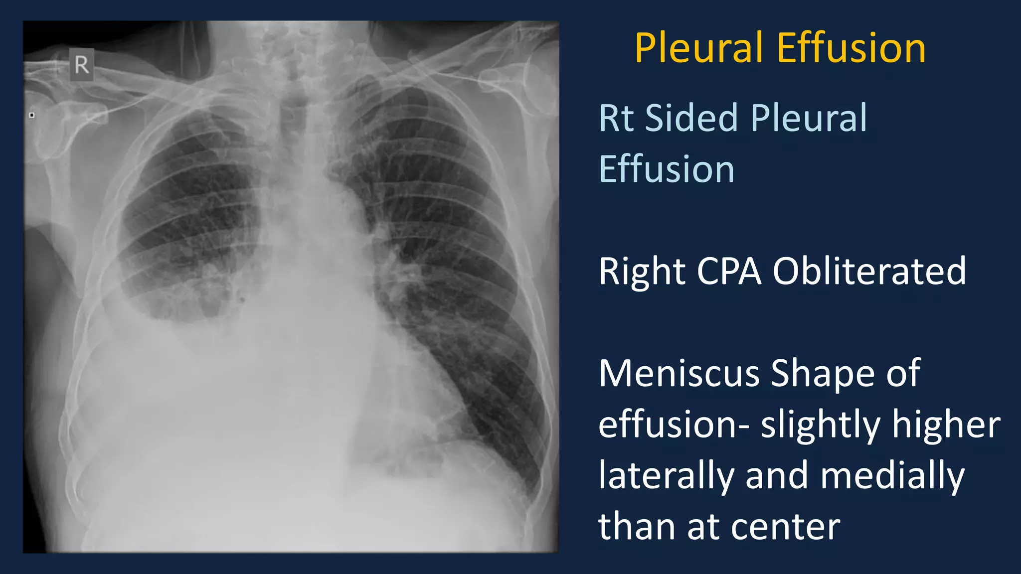 Pediatric Chest x ray Interpretation.pdf