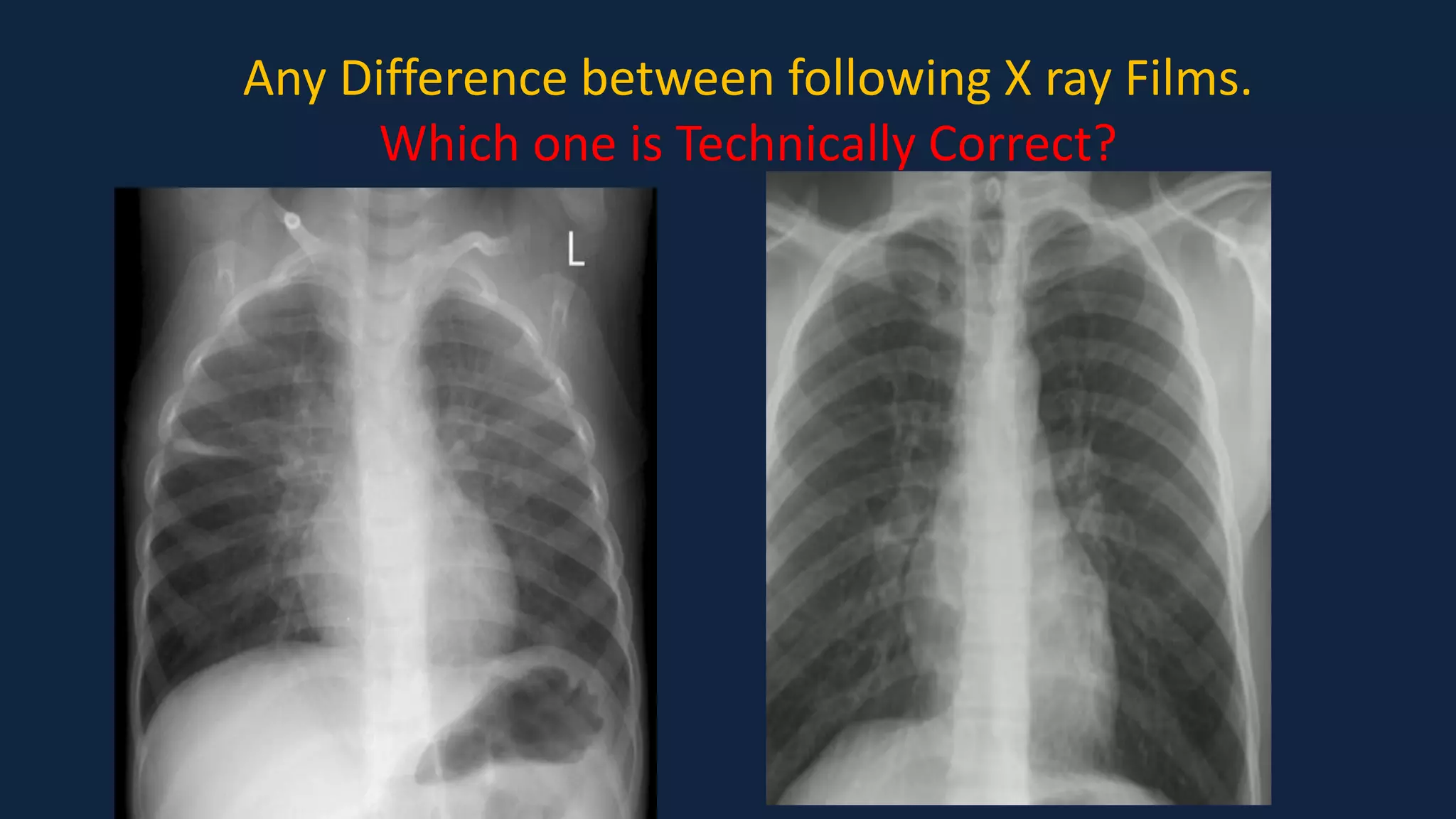 Pediatric Chest x ray Interpretation.pdf
