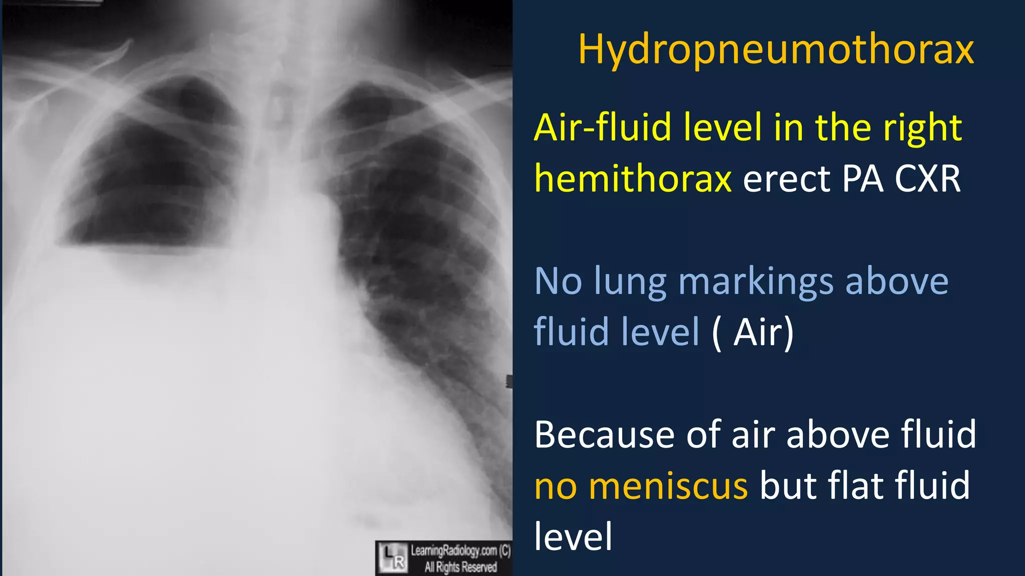 Pediatric Chest x ray Interpretation.pdf
