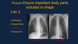 Pediatric Chest x ray Interpretation.pdf