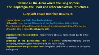 Pediatric Chest x ray Interpretation.pdf