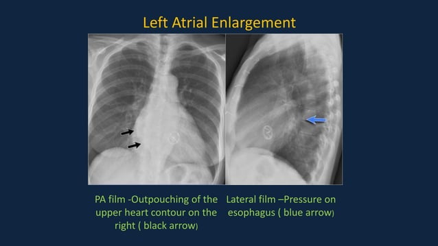 Pediatric Chest x ray Interpretation.pdf