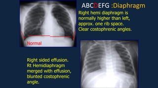 Pediatric Chest x ray Interpretation.pdf