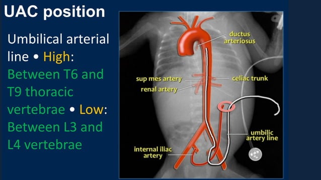 Pediatric Chest x ray Interpretation.pdf