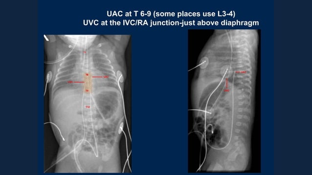 Pediatric Chest x ray Interpretation.pdf