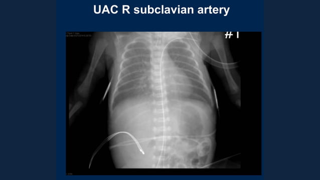 Pediatric Chest x ray Interpretation.pdf