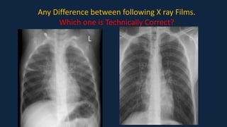 Pediatric Chest x ray Interpretation.pdf