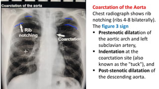 Pediatric Chest x ray Interpretation.pdf