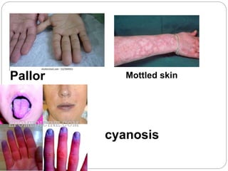 pediatric circulation.pptx