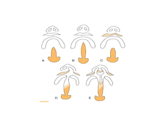 pediatric cleft lip and palate presentation.pptx