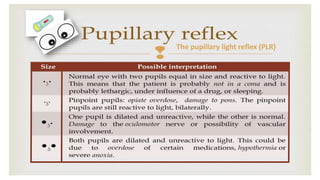 Pediatric Coma | PPT