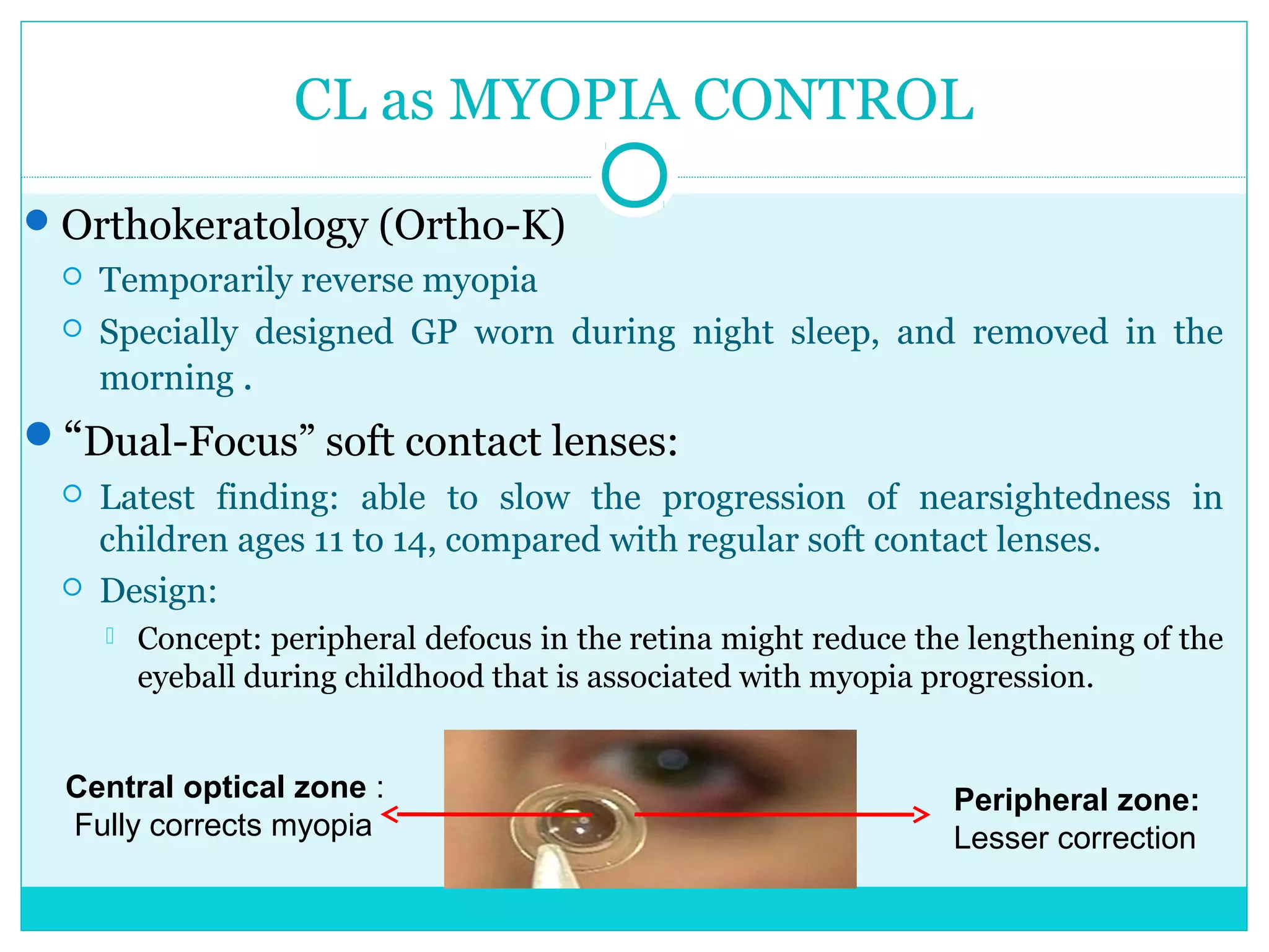 Pediatric contact lens | PPT