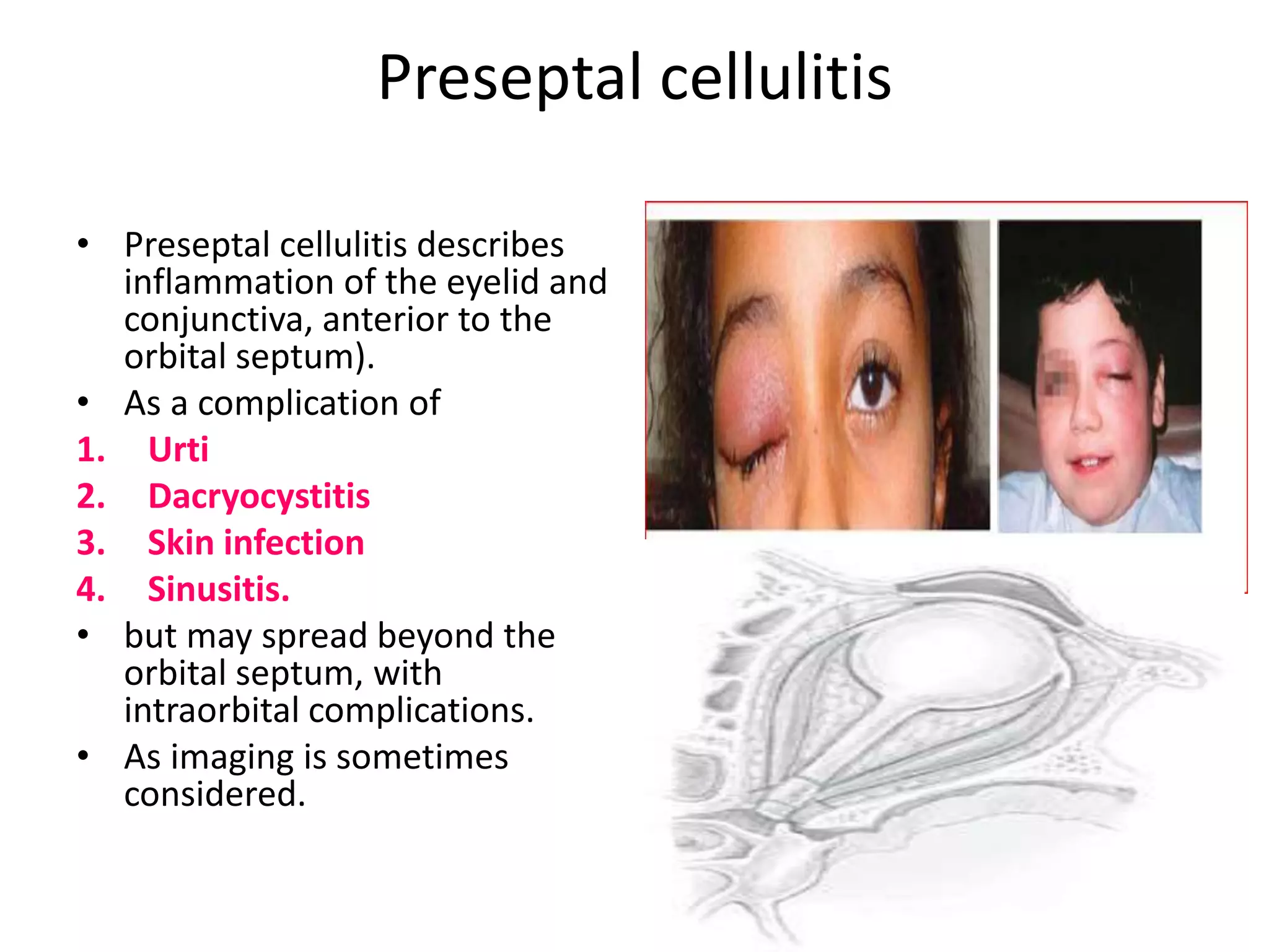 Pediatric crs complications final | PPTX