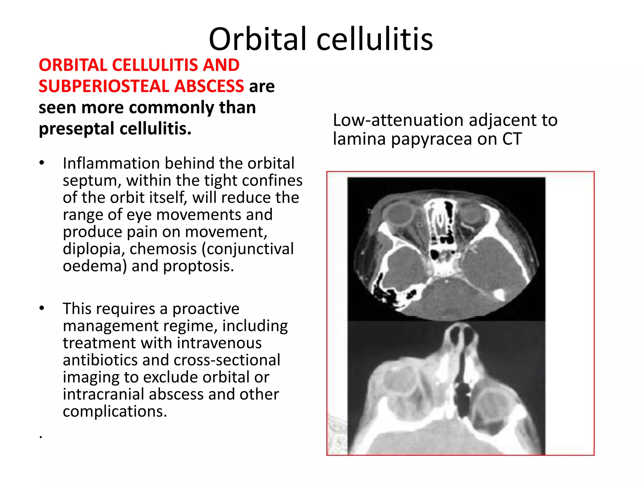 Pediatric crs complications final | PPTX