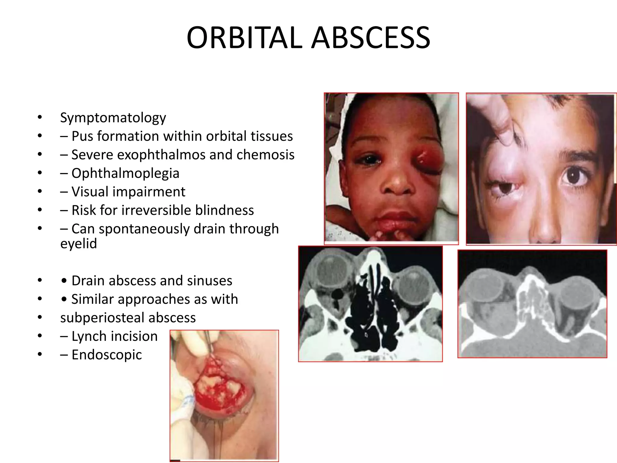 Pediatric crs complications final | PPTX
