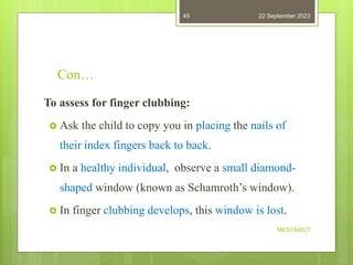 Pediatric CVS examination NEW.pptx
