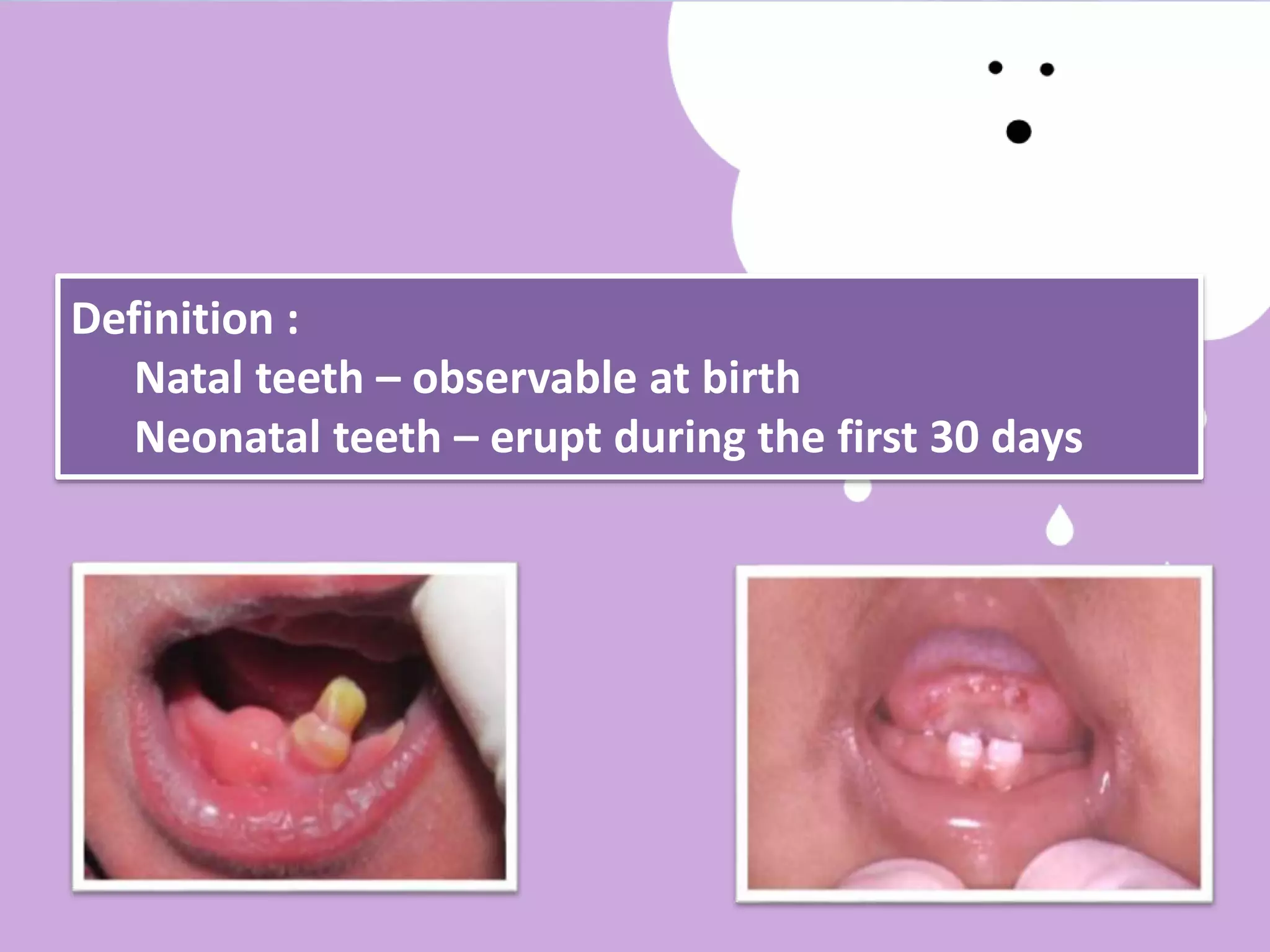 Pediatric dentistry | PPTX