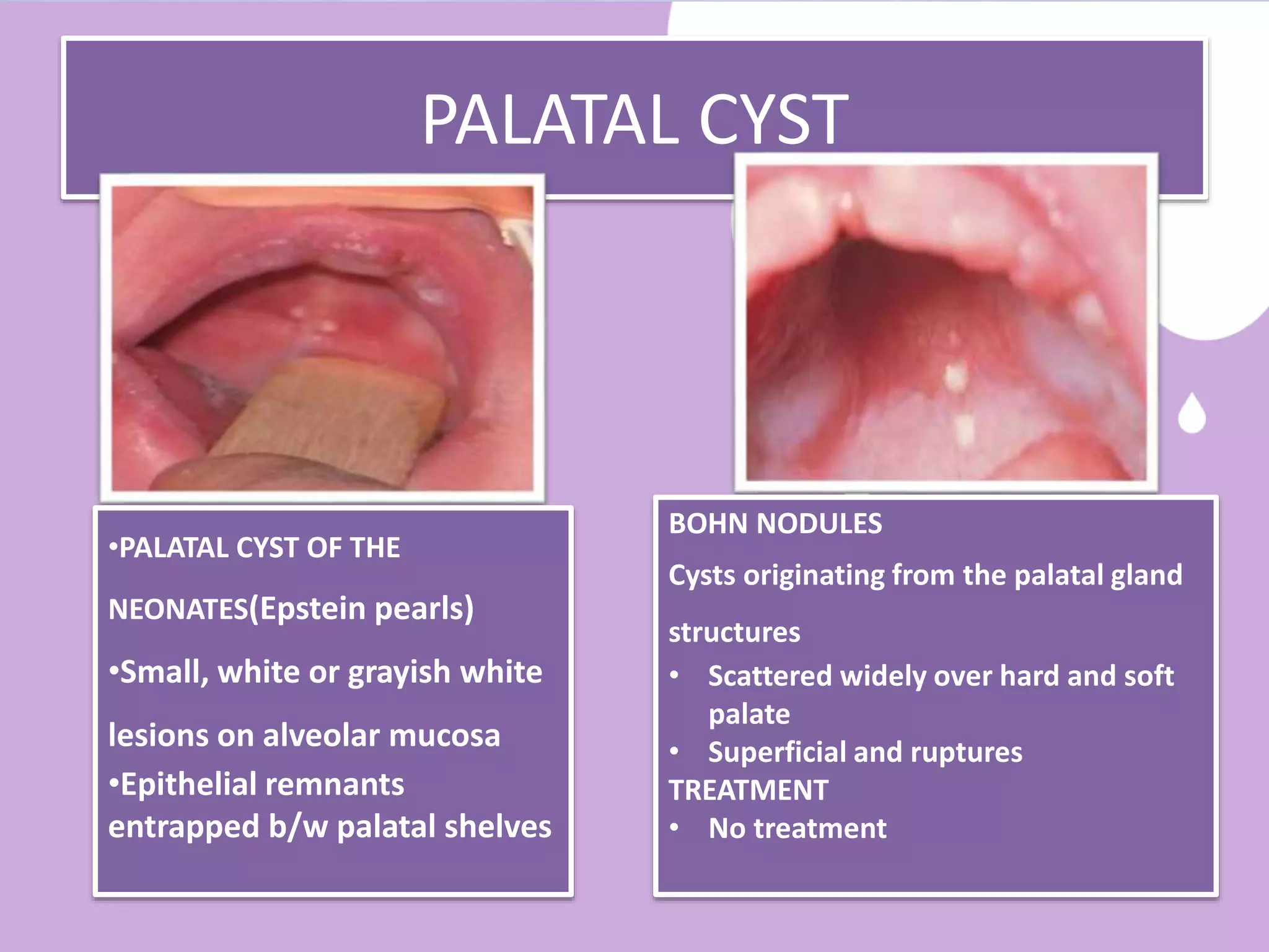 Pediatric dentistry | PPTX