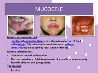 Pediatric dentistry | PPTX