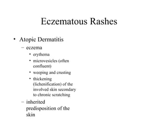 Pediatric Dermatology | PPT